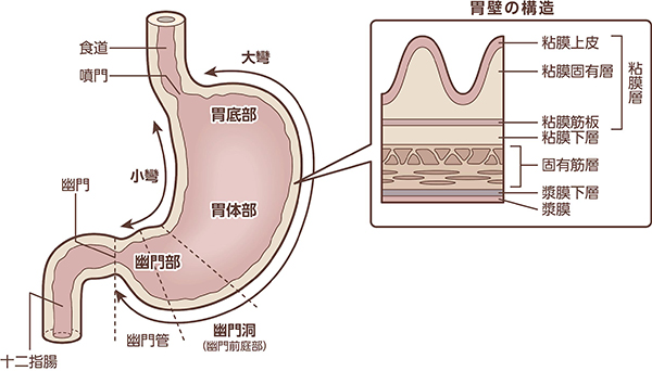 胃潰瘍・十二指腸潰瘍の原因・検査・治療 東京都池袋駅の消化器内科